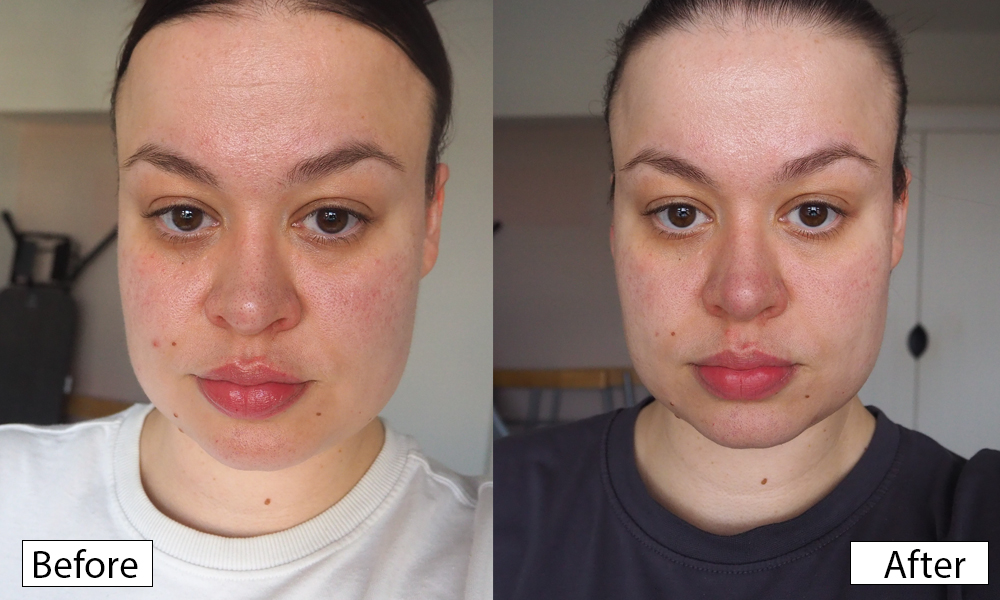 Project E Beauty LumaLux Face Pro review (with before and after photos ...
